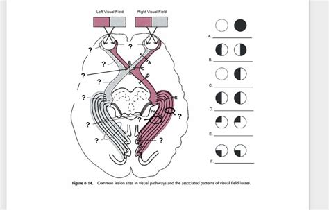 Neuro Diagram 4 Diagram Quizlet