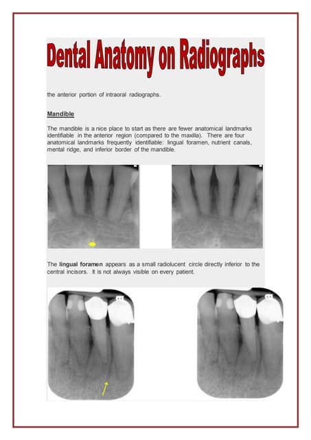 Nutrient Canal Radiograph Adae International Adae International