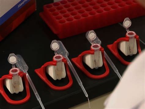 Conversion Of A Capture Elisa To A Luminex Xmap Assay Using A Multiplex