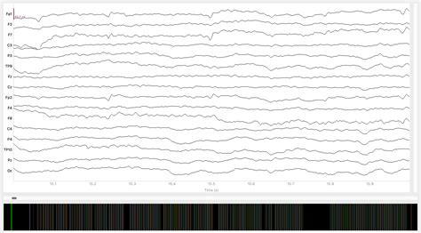 Visualizing Raw Eeg Using Mne — Neural Data Science In Python