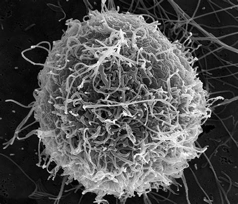 Top Scientist This Version Of Ebola Looks Like ‘a Very Different Bug