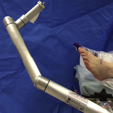 The Images Showing Great Toe Metatarsalphalangeal Joint Arthroscopy