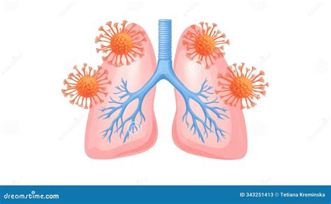 Understanding Copd Detailed Illustration Of Lung Symptoms Royalty Free