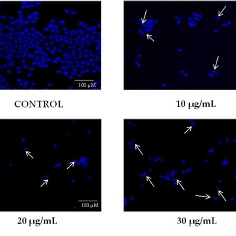 Dapi Staining In Mcf 7 Cell Lines Variation In Nuclear Morphology