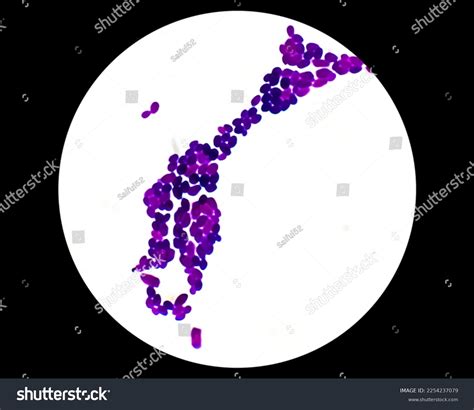 1336 Candida Cells Royalty Free Photos And Stock Images Shutterstock