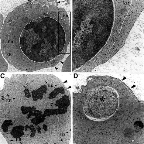 Ultrastructural Characteristics Of Polychromatic Erythroblasts A An Download Scientific