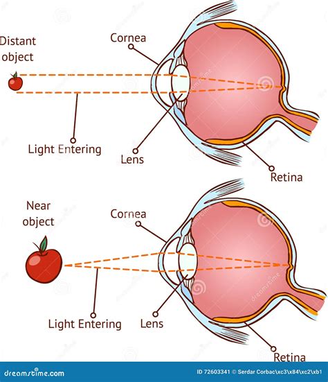 Myopia And Normal Vision Stock Vector Illustration Of Anatomical
