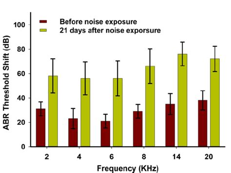 Abr Threshold Shift Measured At Different Frequencies Before And 21 Download Scientific Diagram