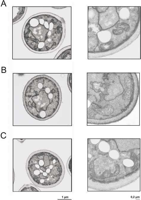 Yeast Cells Under Transmission Electron Microscope