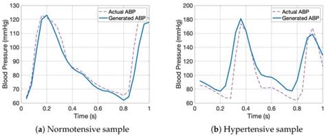 A Machine Learning Approach To The Non Invasive Estimation Of