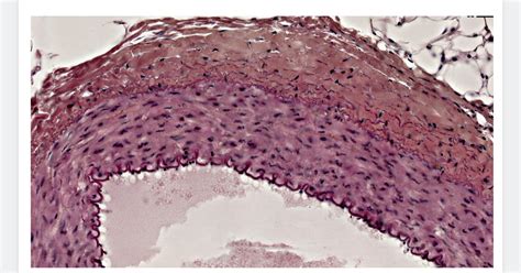 Blood Vessel Histology Diagram Quizlet