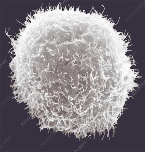 Macrophage SEM Stock Image P276 0272 Science Photo Library