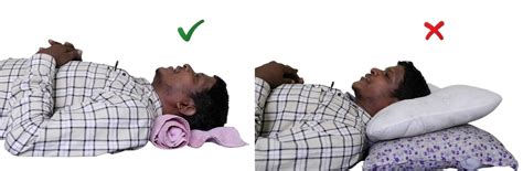 Cervical Lordosis Exercises