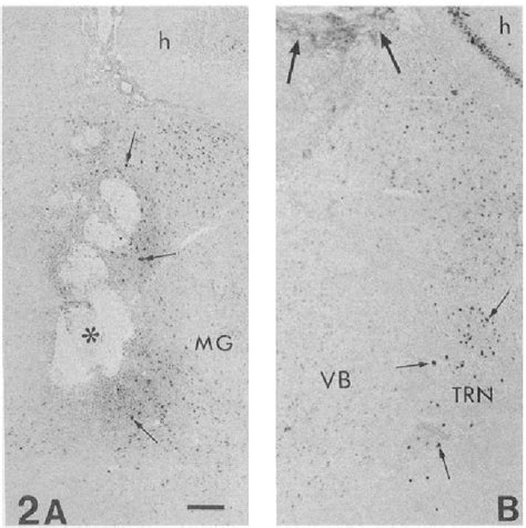 Figure 2 From The Effects Of A Lesion Or A Peripheral Nerve Graft On