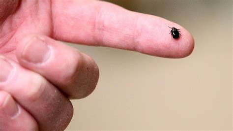 Know What To Look For This Tick That Causes Lyme Disease Is On The