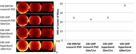 Hyperband Transition Center For Cognitive And Neurobiological Imaging