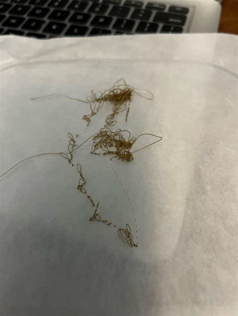 My Bobbin Thread Is Not Catching On At All Rmachineembroidery