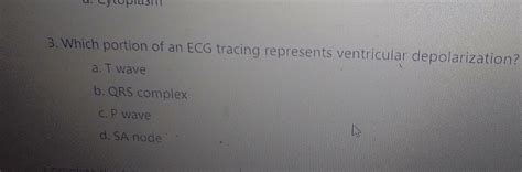 Solved Which Portion Of An ECG Tracing Represents Chegg