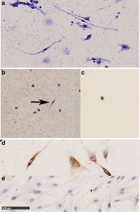 Fibrocyte Measurement In Peripheral Blood Correlates With Number Of