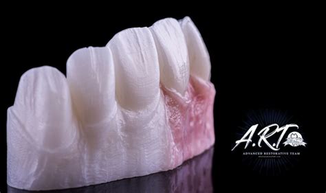 Jack Marrano Case 1 Miyo World