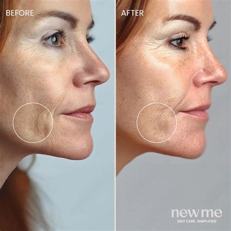 Jennifer Anistons Anti Aging Serum The Science Behind Her Ever