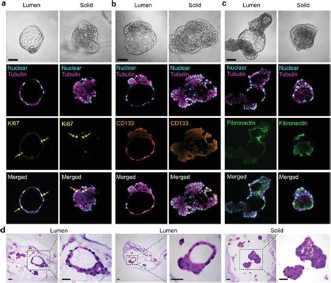 Immunostaining Analysis Of Mammary Tumor Organoids A Ki67 Expression
