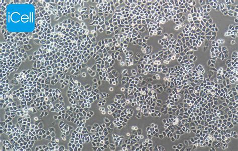 人正常卵巢上皮细胞 Str鉴定iose 80 阿仪网