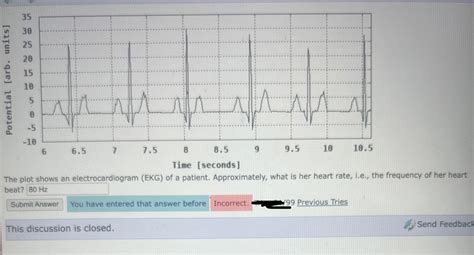 Solved The Plot Shows An Electrocardiogram Ekg ﻿of A