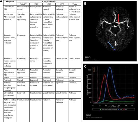 Computed Tomography Perfusion Imaging In Acute Ischemic Stroke