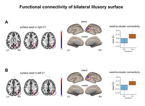 Results Of The Seed Based Functional Connectivity A Seed In Illusory