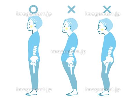 シニア男性の良い姿勢と悪い姿勢の見本骨盤のイラスト素材 207523295 イメージマート