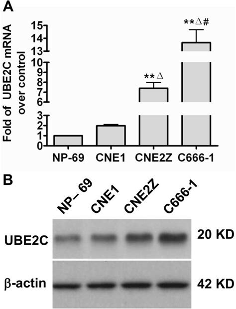 Ube2c Expression In Variously Differentiated Npc Cell Lines And Np 69