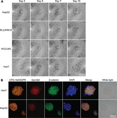 3d Culture Of Circulating Tumor Cells For Evaluating Early Ott