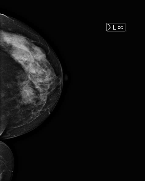 Testinst Instance Segmentation Dataset By Spatuyz