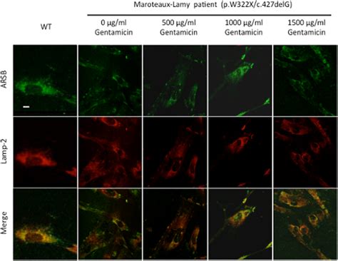 Confocal Microscopy Analysis Of Fibroblasts Treated With Download Scientific Diagram