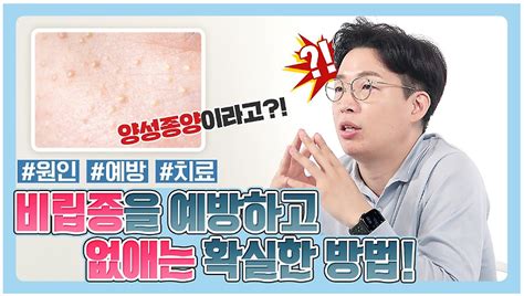 비립종 없애는 방법 효과적인 치료와 예방 전략