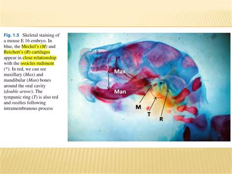 Temporal Bone And Mastoid Anatomy Arjun Antony Graison Ppt