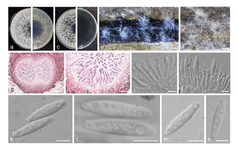 Botryosphaeria Eriobotryae Facesoffungi Number Fof 12930 Faces Of Fungi