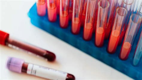 Peripheral B Cells In Pathophysiology And Diagnosis Of Multiple Sclerosis