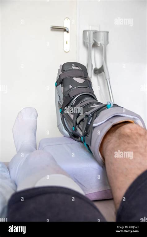 European Man After Achilles Tendon Rupture Operation Is Back Home With