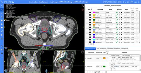 The Automation Era Enhancing Speed And Precision In Radiotherapy Physics World