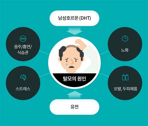 탈모의 원인과 치료 탈모이야기 마이모 남녀가발제작