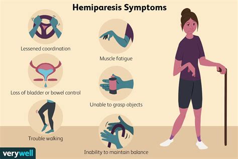 Stroke Patient Hemiparesis