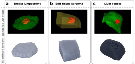 Anthropomorphic Models And 3d Printed Material For A Breast Lumpectomy Download Scientific