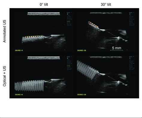Implant Thread Pitch And Thread Depth Measurement Dependence On The