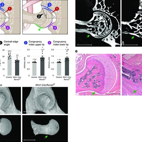 Loss Of Piezo2 In Proprioceptive Neurons Results In Spine Malalignment