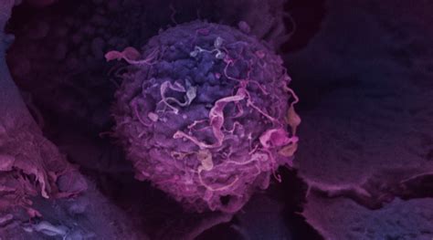 Existing Drug Could Be Used To Target Aggressive Breast Cancer Future