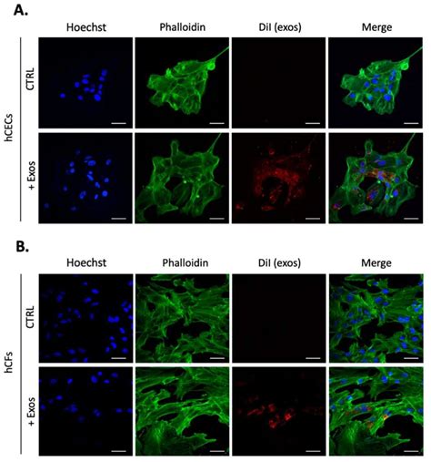 Labeling Exosomes With Lipophilic Dyes Creative Biostructure
