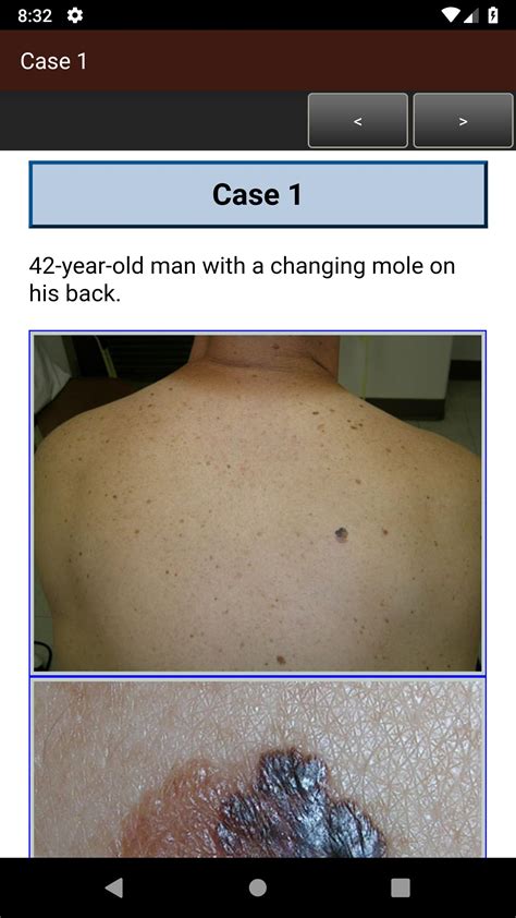 Baixar Apk De Dermoscopy Para Android Última Versão