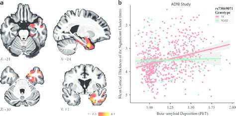 A Results For Whole Brain Voxel Based Analysis Of Download Scientific Diagram